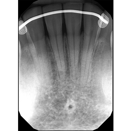 Clio Prime Digital X-Ray Sensor - SOTA Imaging