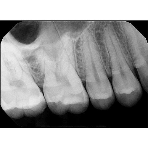 Clio Prime Digital X-Ray Sensor - SOTA Imaging