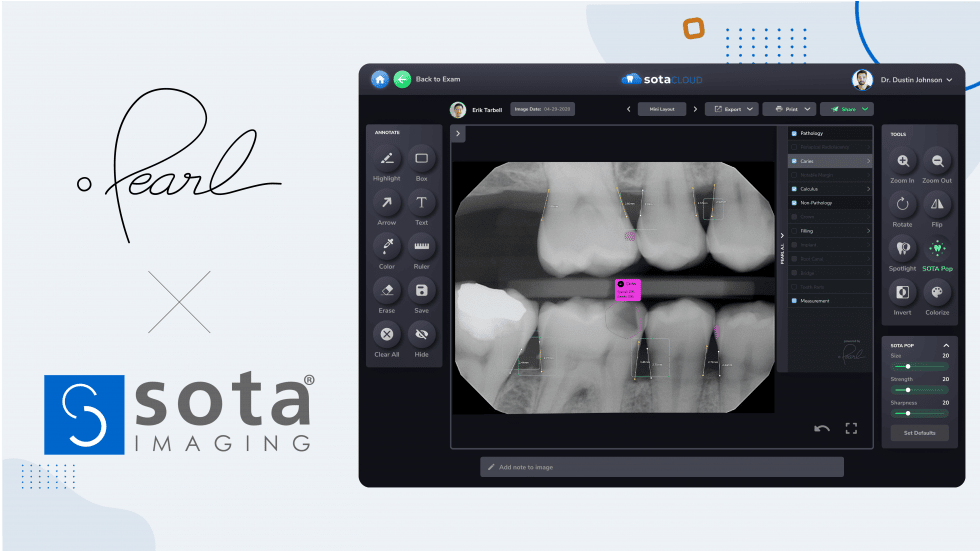 SOTA Cloud’s Dental Imaging Software Gets Pearl’s AI Pathology Detection Capabilities - SOTA Imaging